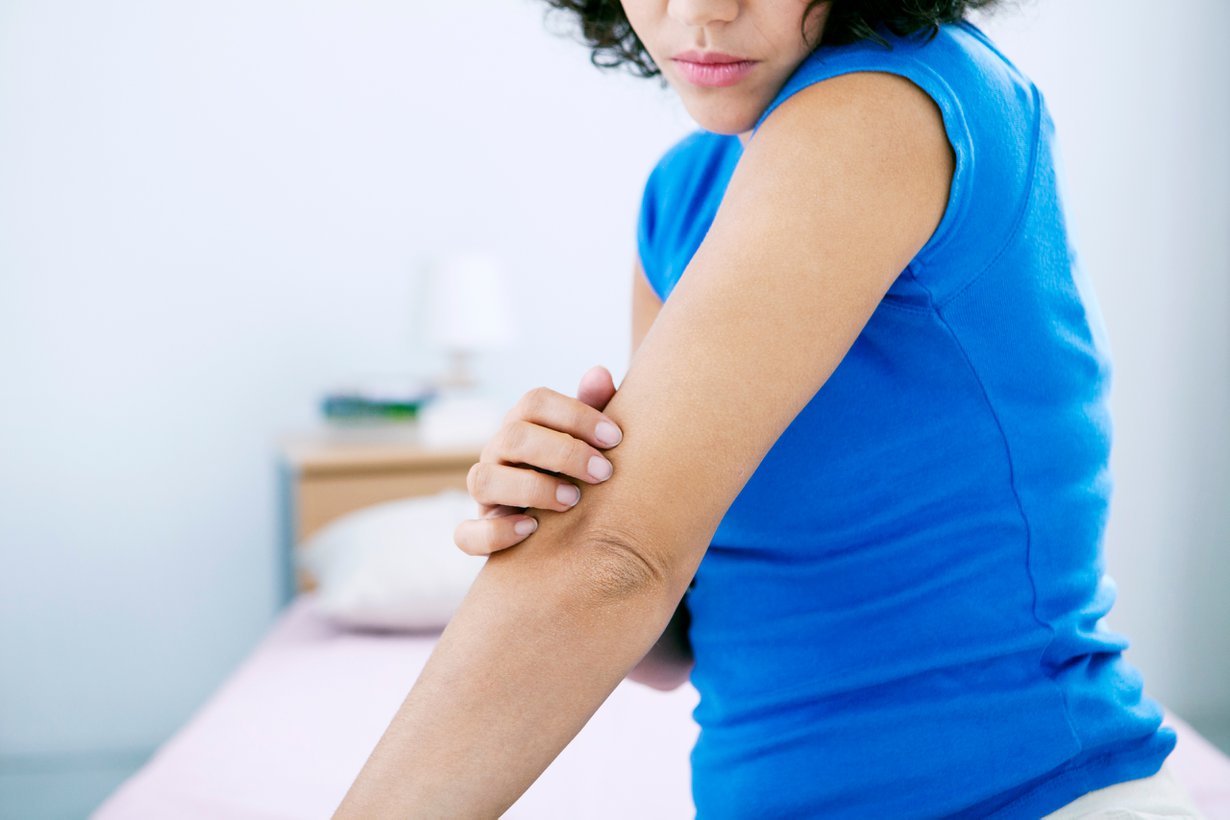 Psoriaasi | Hyvä Terveys